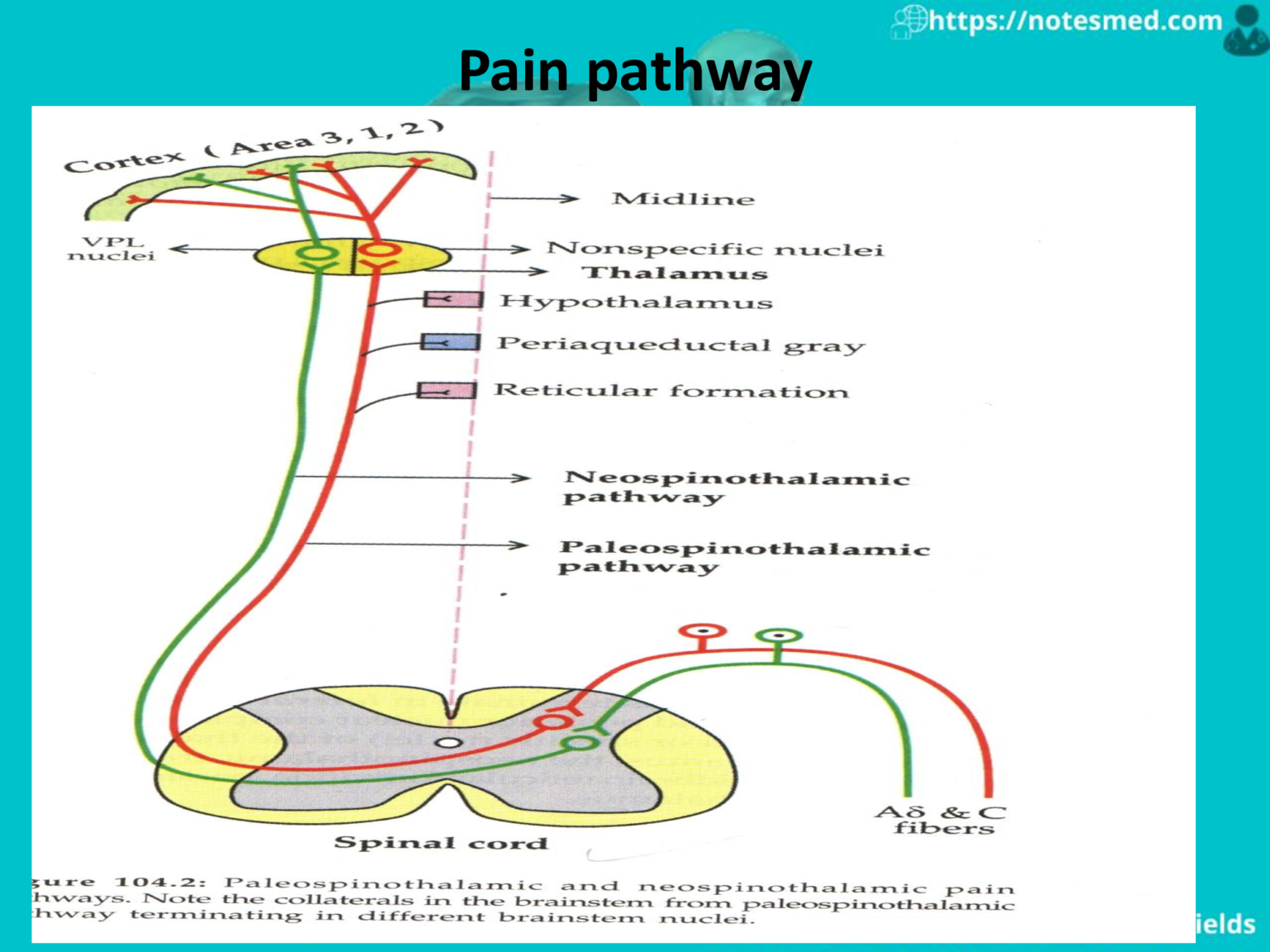 Physiology Of The Pain: Pathway, Types, Referred Pain | NotesMed