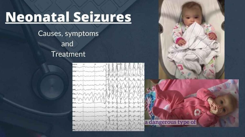 Comprehensive Guide To Neonatal Seizures: 6-Symptoms